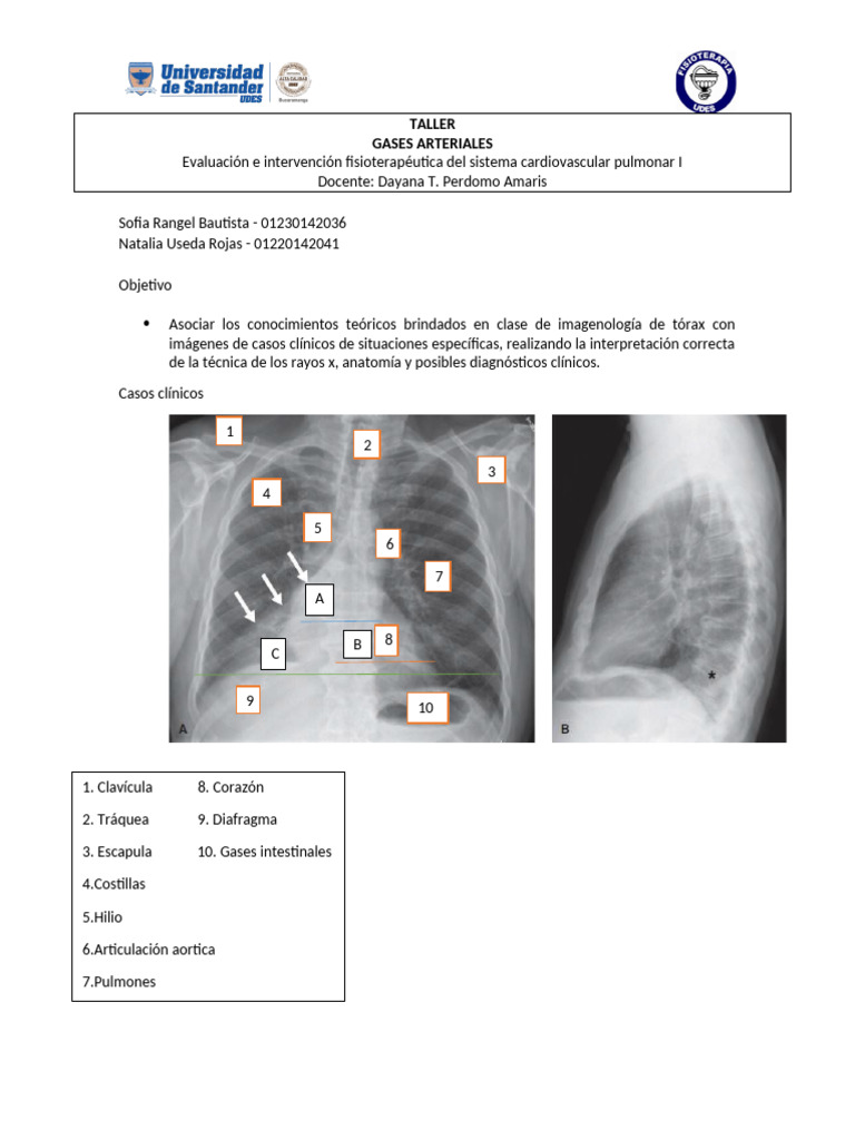 Taller Radiología de Tórax NYS (1) | PDF | Pulmón | Tórax