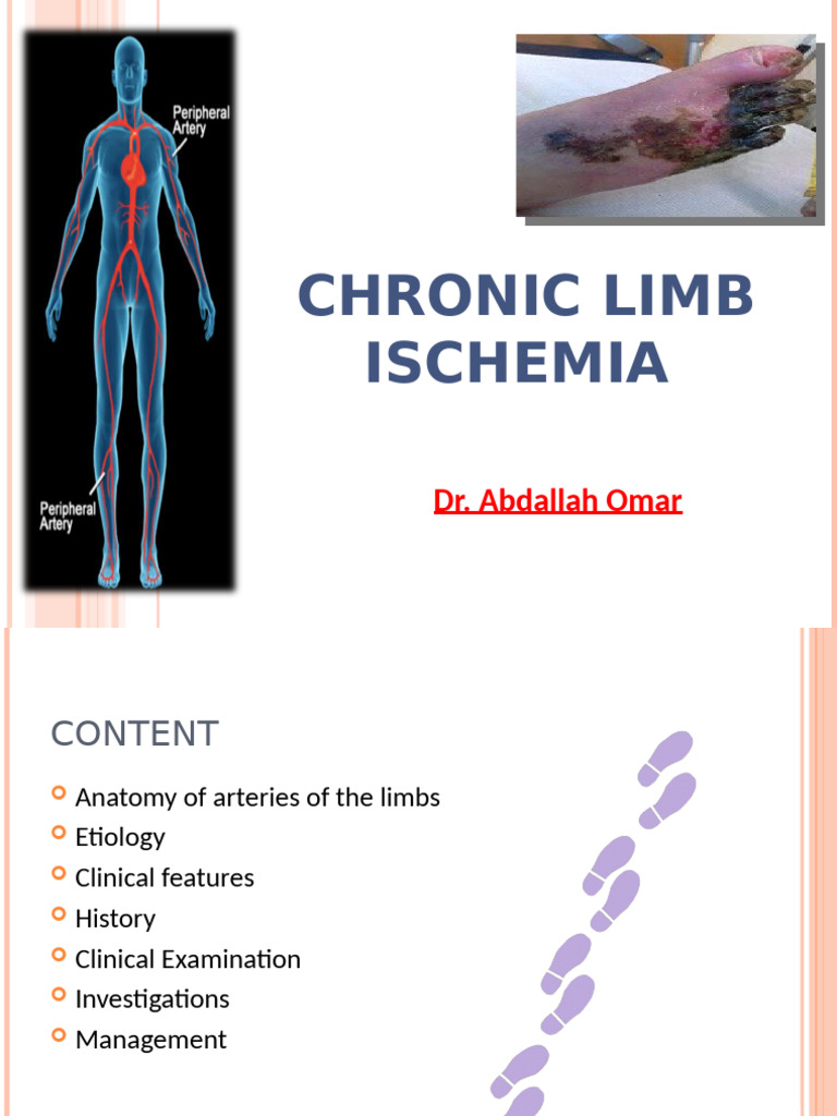 Chronic Limb Ischemia Overview and Management | PDF | Ischemia ...