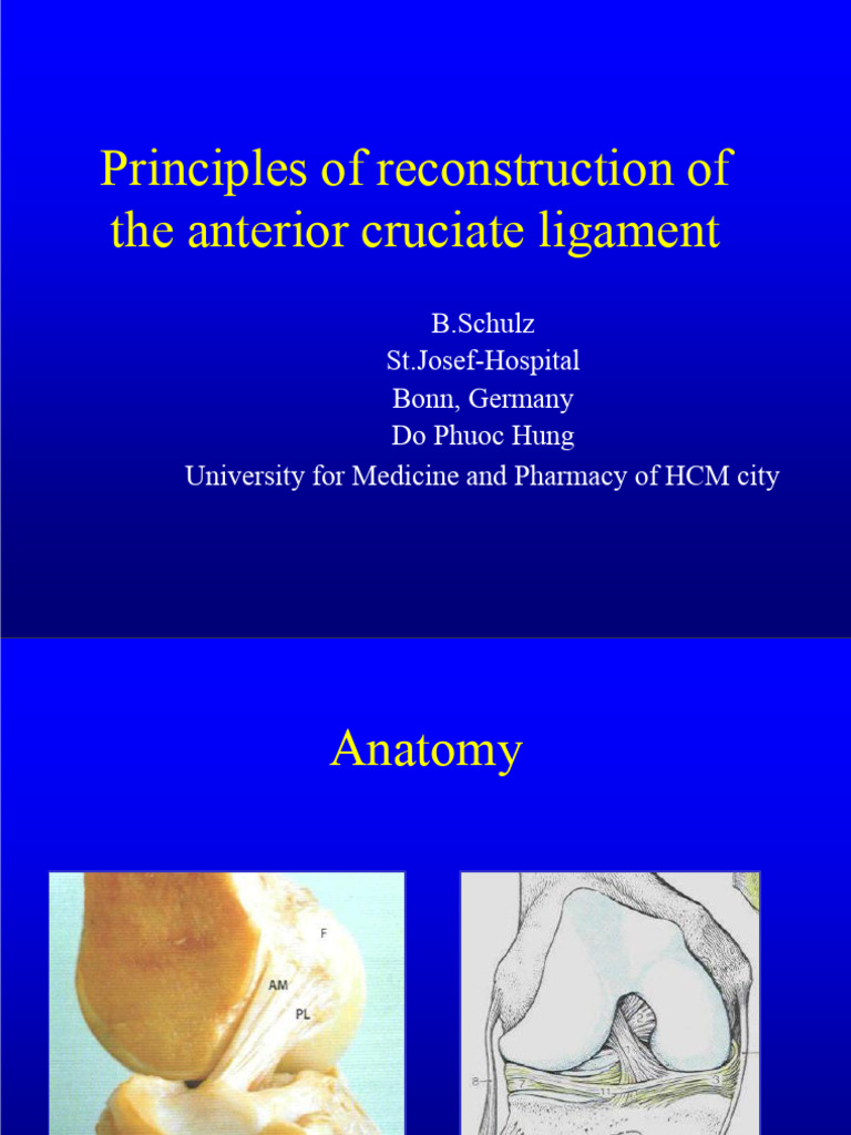 ACL - Chan Doan - Dieu Tri | PDF | Knee | Musculoskeletal Disorders