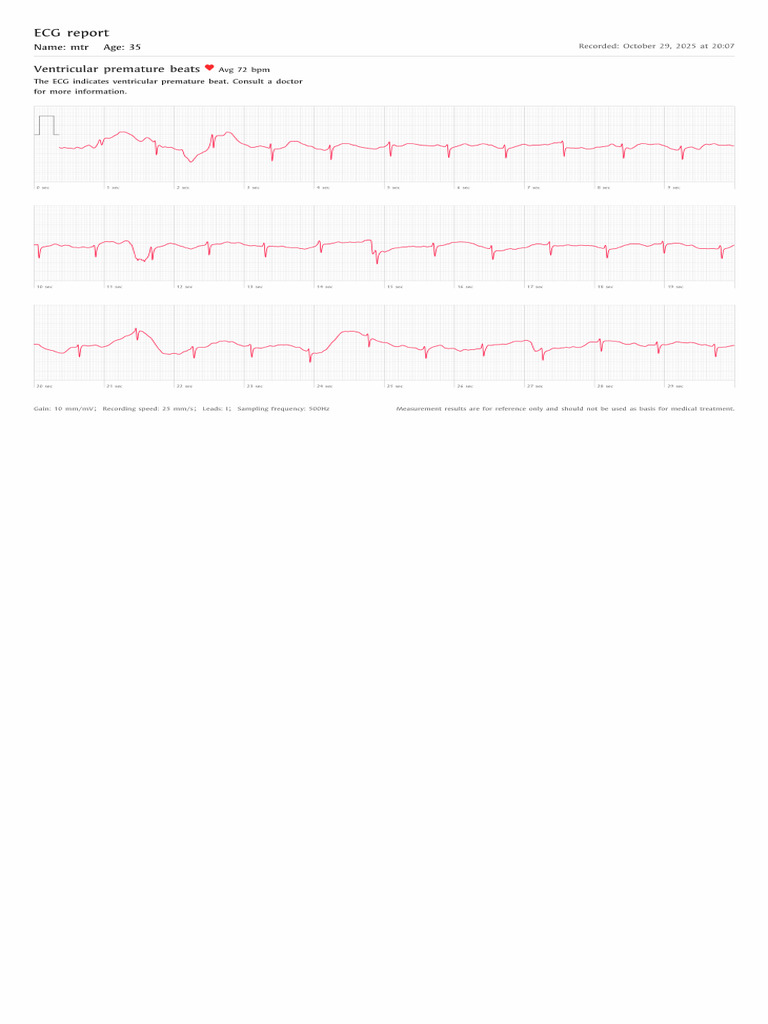Ecg Report 20251029200901 | PDF