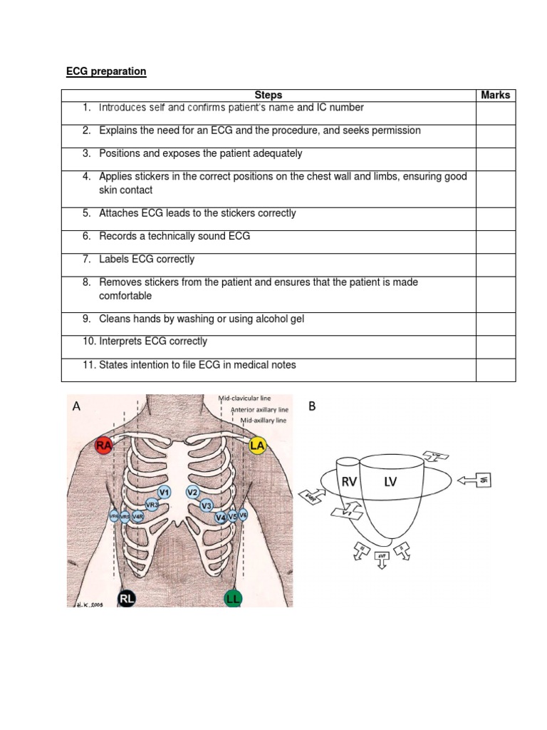 ECG Preparation | PDF