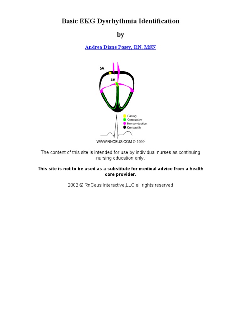 Basic EKG Dysrhythmia Identification | PDF | Cardiac Arrhythmia ...