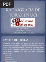 Modelo de Un Informe Radiológico de Una RX Pa de Torax Normal | PDF
