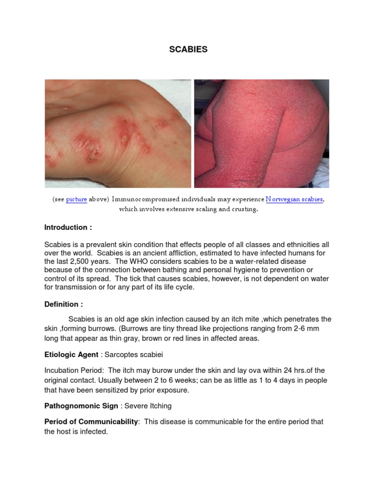 Scabies | PDF | Immunology | Medical Specialties