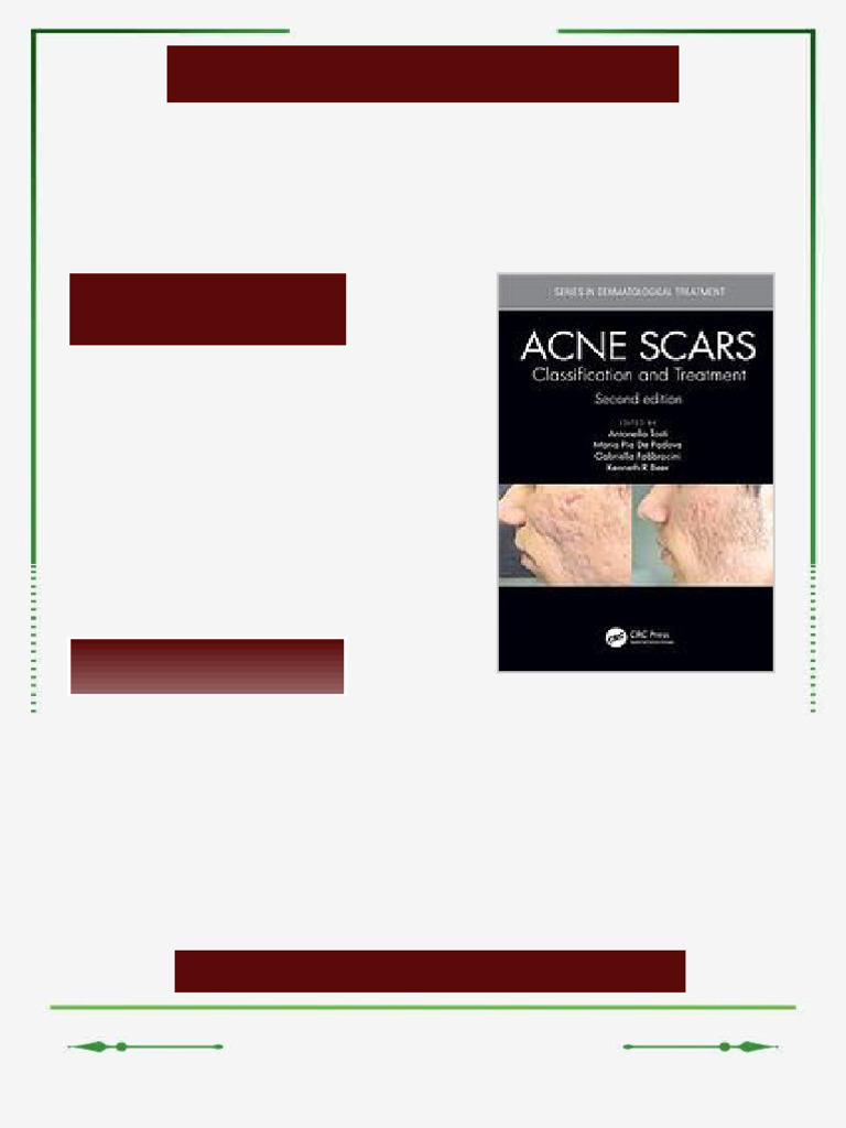 Acne Scars: Classification And Treatment 2nd Edition Antonell Tosti ...