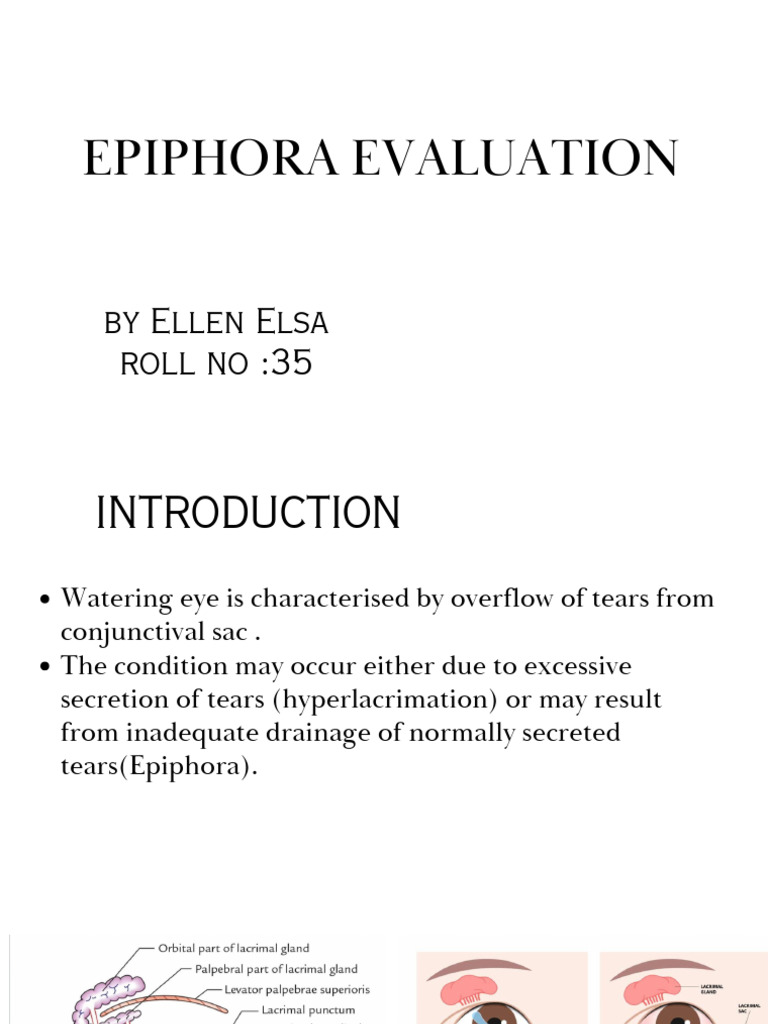 Epiphora - PPTX 20251016 234020 0000 | PDF | Medical Specialties ...