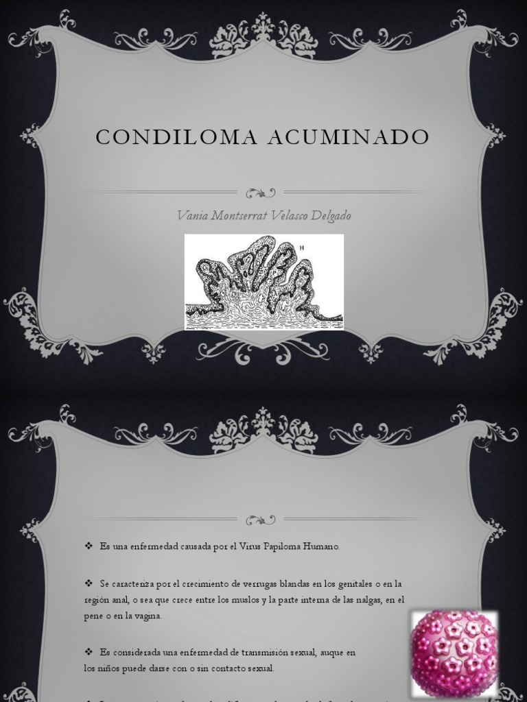 Condiloma Acuminado: Síntomas y Tratamiento | PDF | Ginecología ...