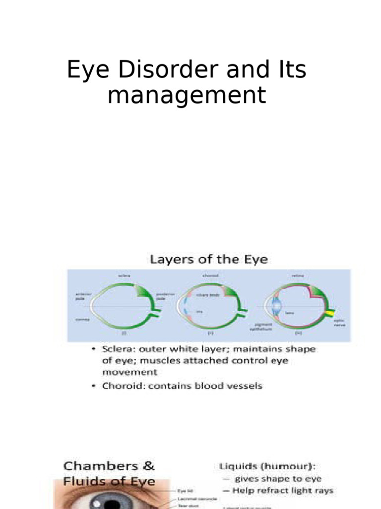 Eye Disorder and Its Management | PDF