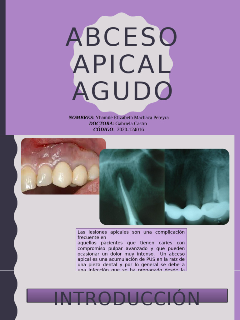 Abceso Apical Agudo | PDF | Especialidades Medicas | Enfermedades y ...
