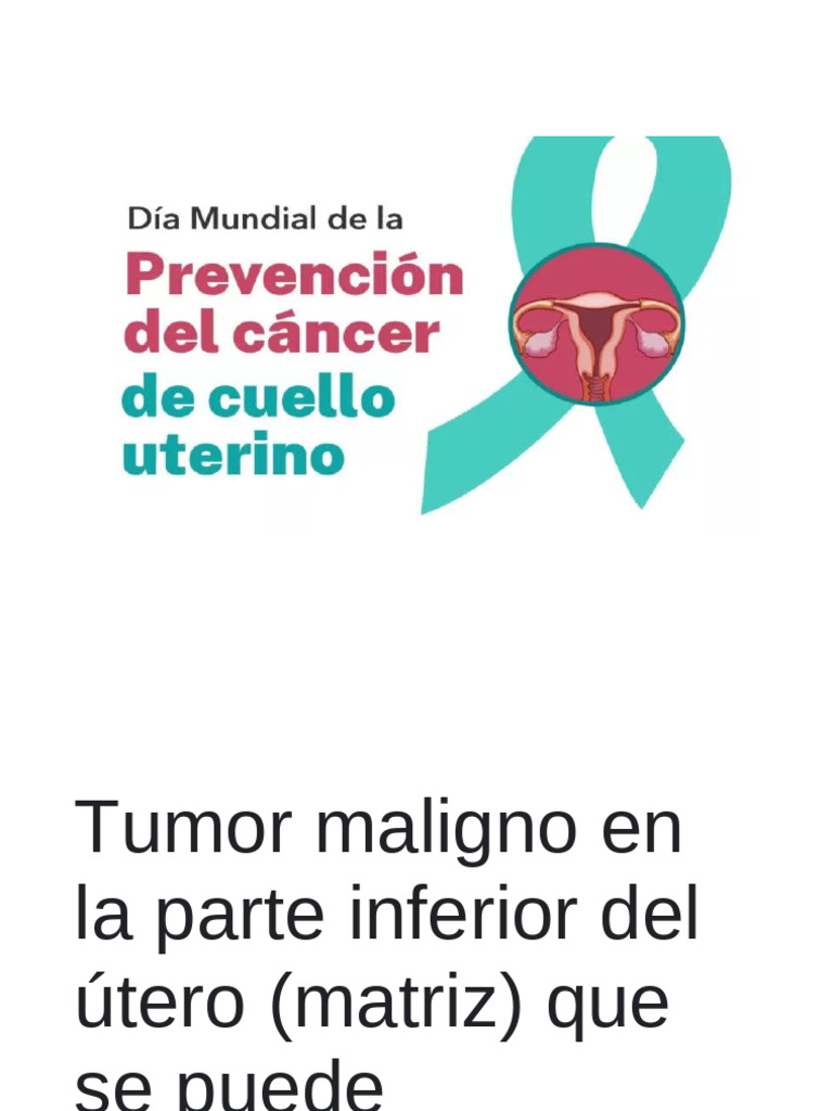 Cancer Cervicouterino | PDF