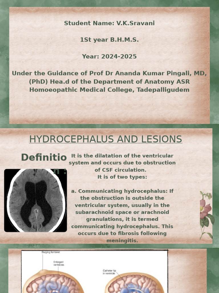 Hydrocephalus and Lesions by V.k.sravani Rolln62 - 20251115 - 222200 - 0000 | PDF