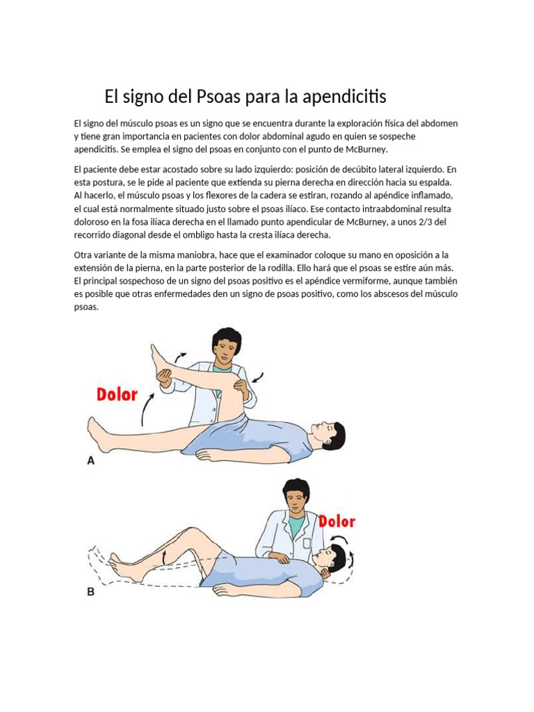 Hueso Coxal y Signo Del Psoas | PDF