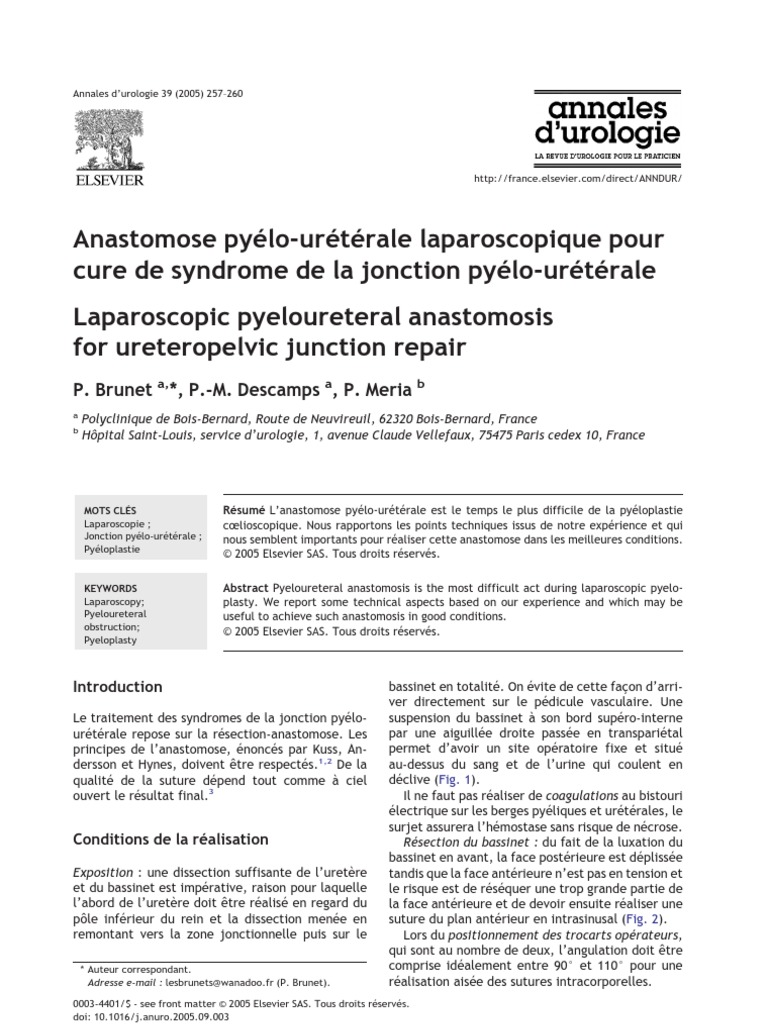 Anastomose Pyélo-Urétérale Laparoscopique Pour Cure de Syndrome de La ...