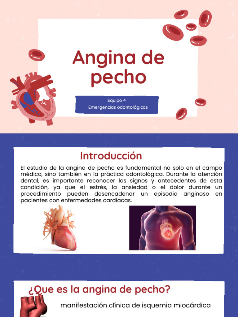 Angina de Pecho PDF | PDF | Medicina CLINICA | Especialidades Medicas