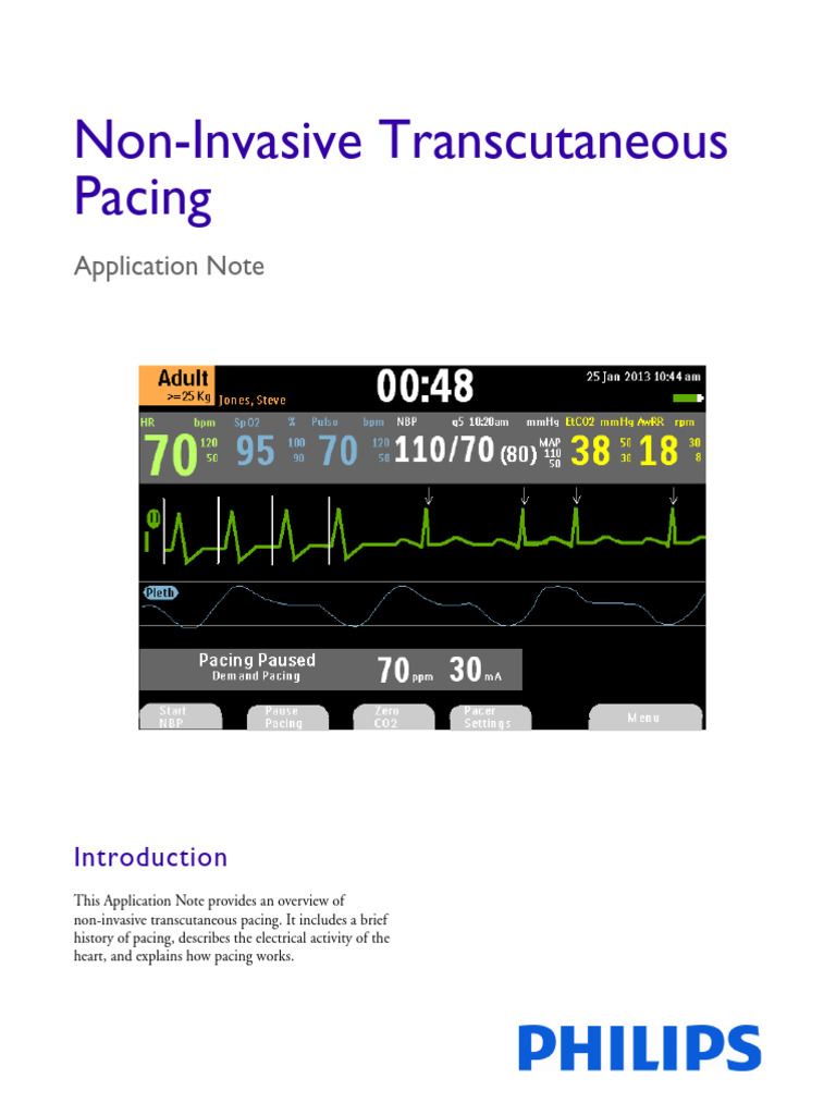 Non-Invasive Transcutaneous Pacing Guide | PDF | Cardiac Muscle ...