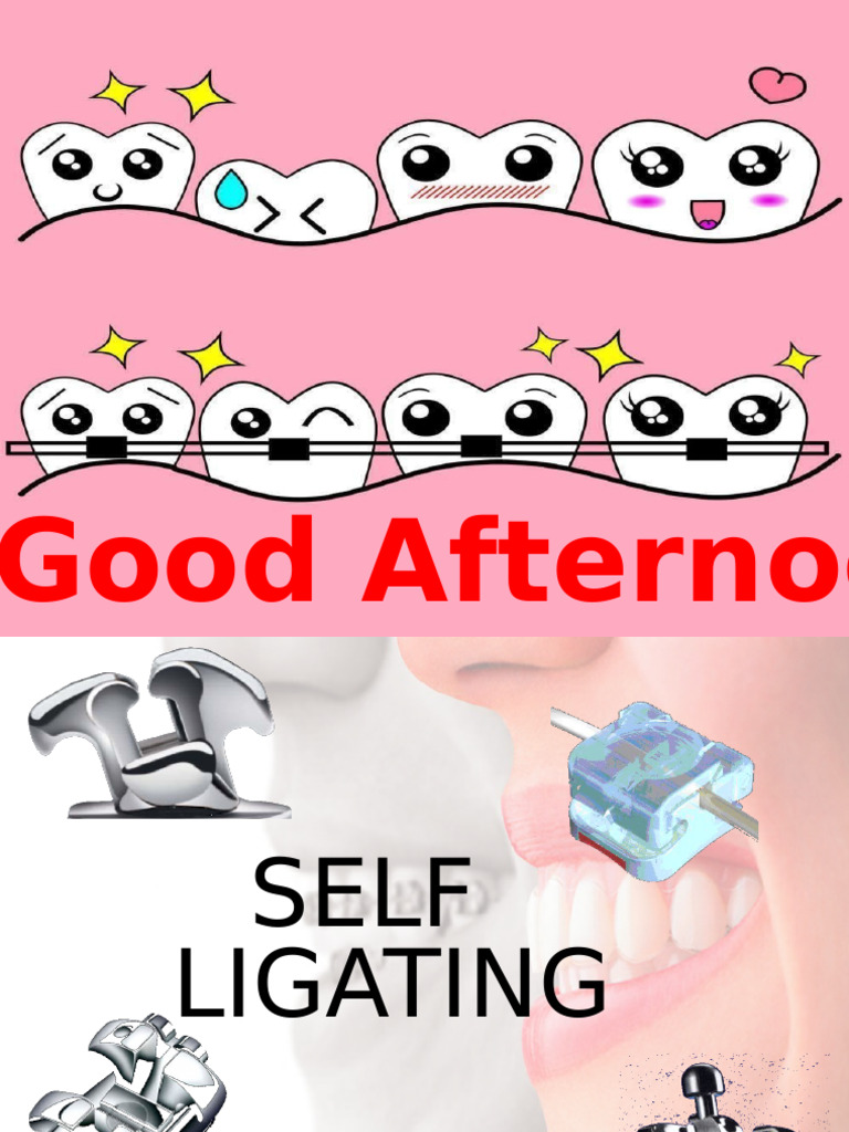 Self Ligating Brackets | PDF | Orthodontics | Dentistry Branches