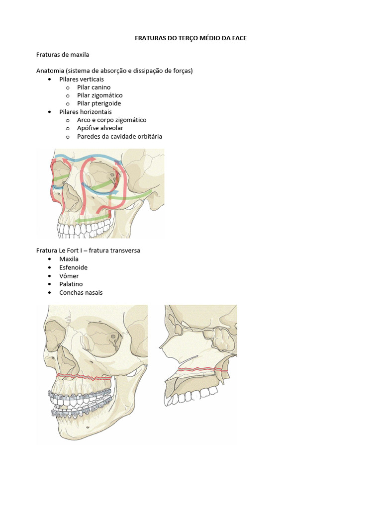 Roteiro - Fraturas Do Terço Médio Da Face | PDF | Crânio | Sistema ...