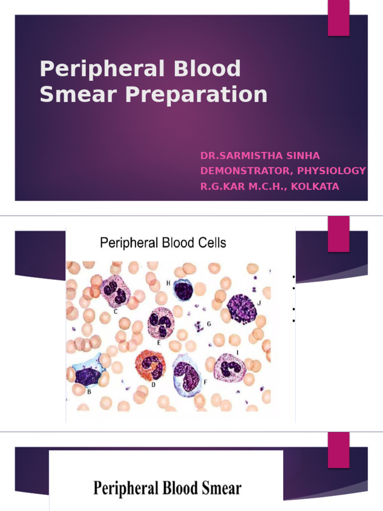 Peripheral Blood Smear Final | PDF