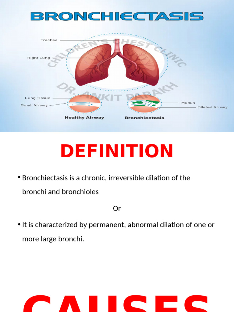 Bronchiectasis | PDF | Medical Specialties | Human Diseases And Disorders