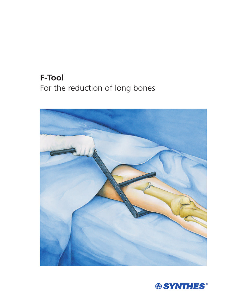 F-Tool Fracture Reduction Tool | PDF | Screw | Musculoskeletal System