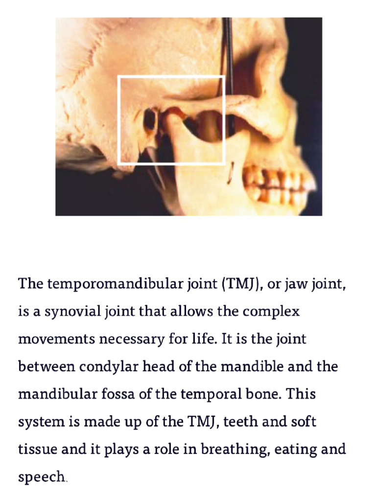 TMJ Joint | PDF