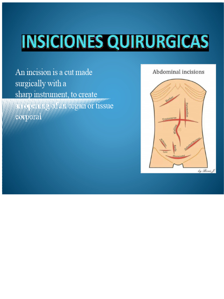 SURGICAL INCISIONS | PDF