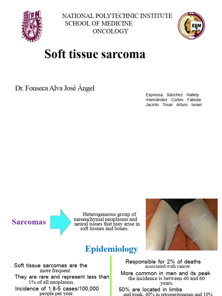 Soft Tissue Sarcoma Onco | PDF | Sarcoma | Radiation Therapy