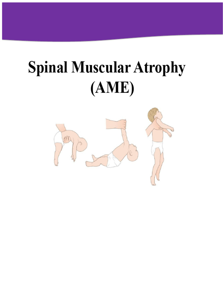 Spinal Muscular Atrophy (SMA) | PDF | Skeletal Muscle | Genetic Disorder