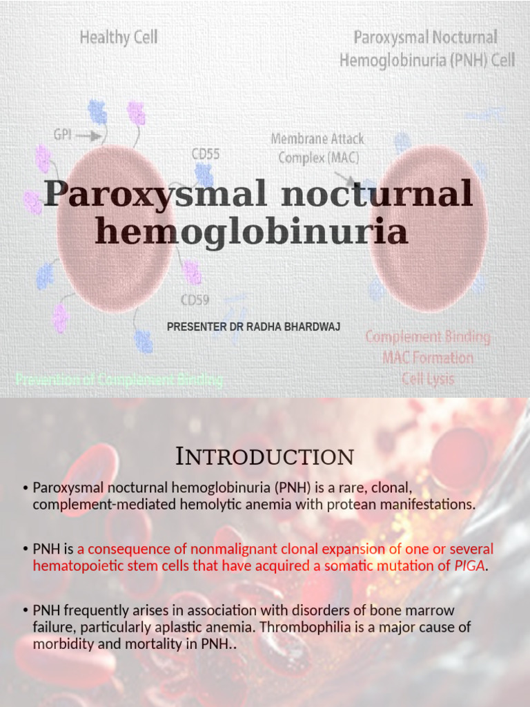 Understanding Paroxysmal Nocturnal Hemoglobinuria | PDF | Anemia | Blood
