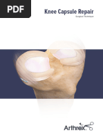 Brostrom Repair with InternalBrace Guide | PDF | Foot | Anatomical ...