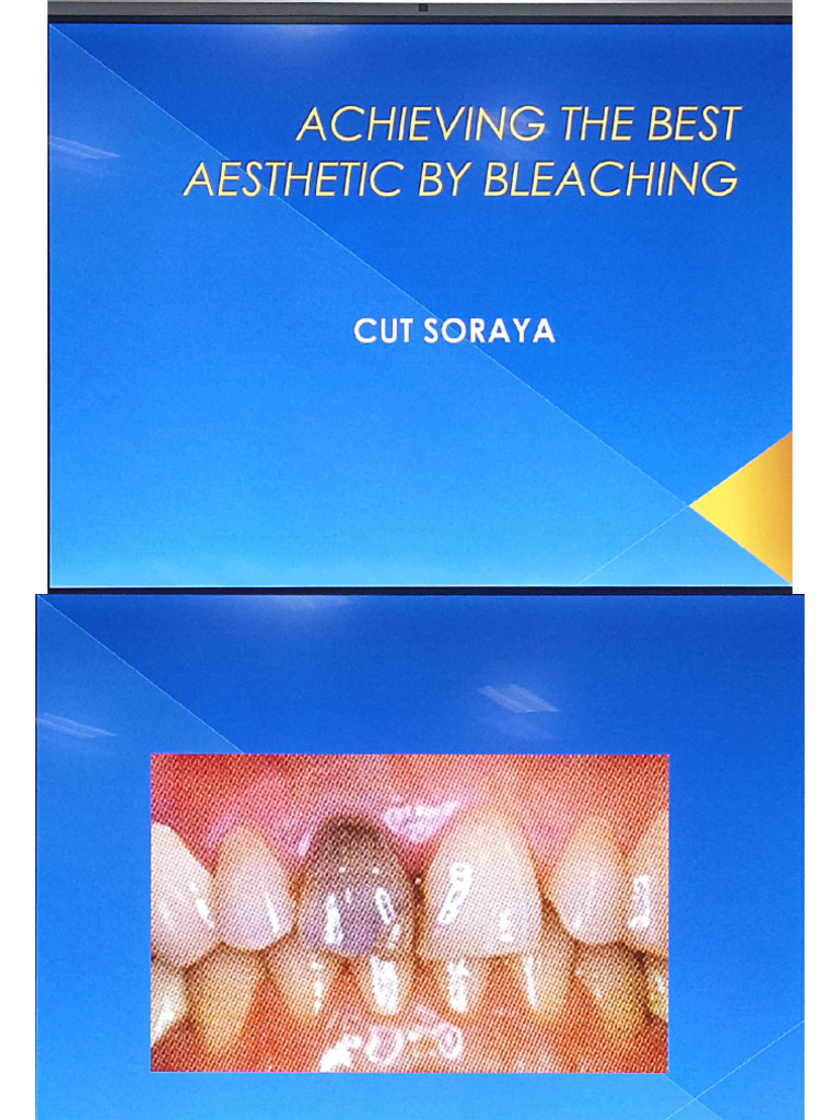 Bleaching Kulpak B8 Prof Aya | PDF