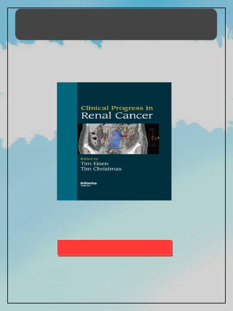 Clinical Progress in Renal Cancer 1st Edition Tim Eisen No Waiting Time | PDF | Kidney | Tobacco ...
