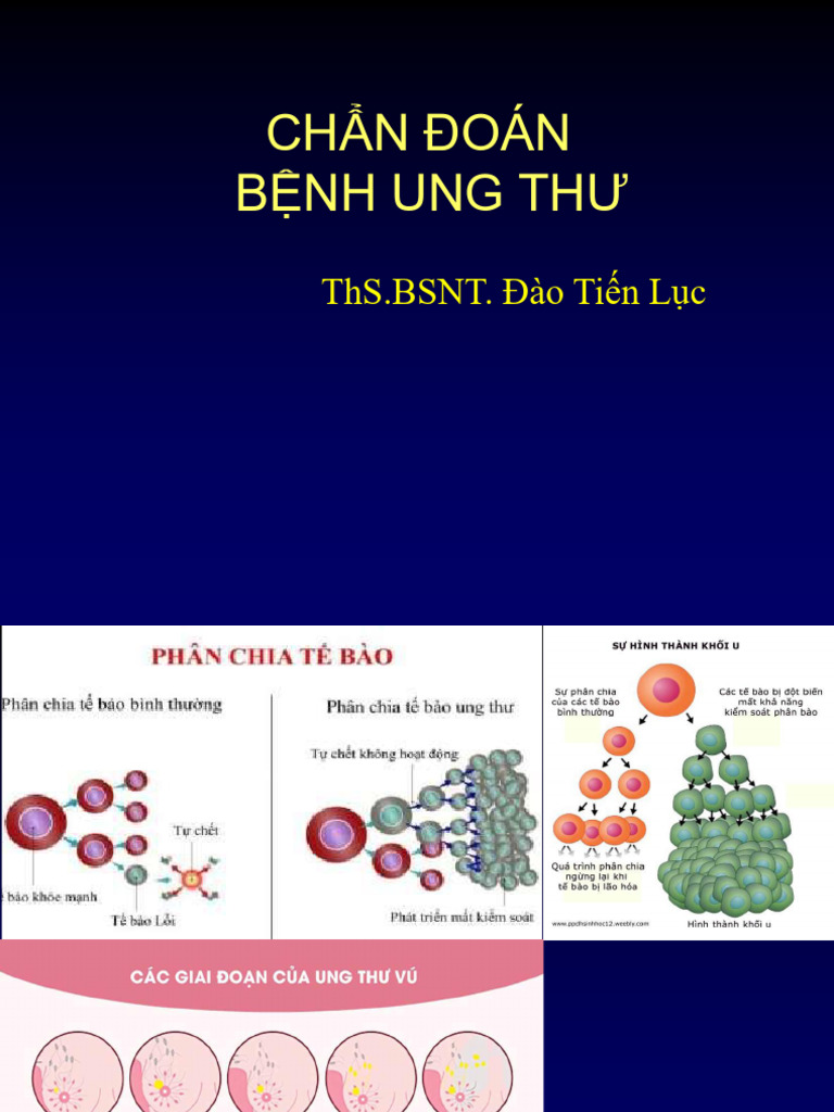 Slide Lec 5 Các Phương Pháp Chẩn Đoán Bệnh Ung Thư | PDF