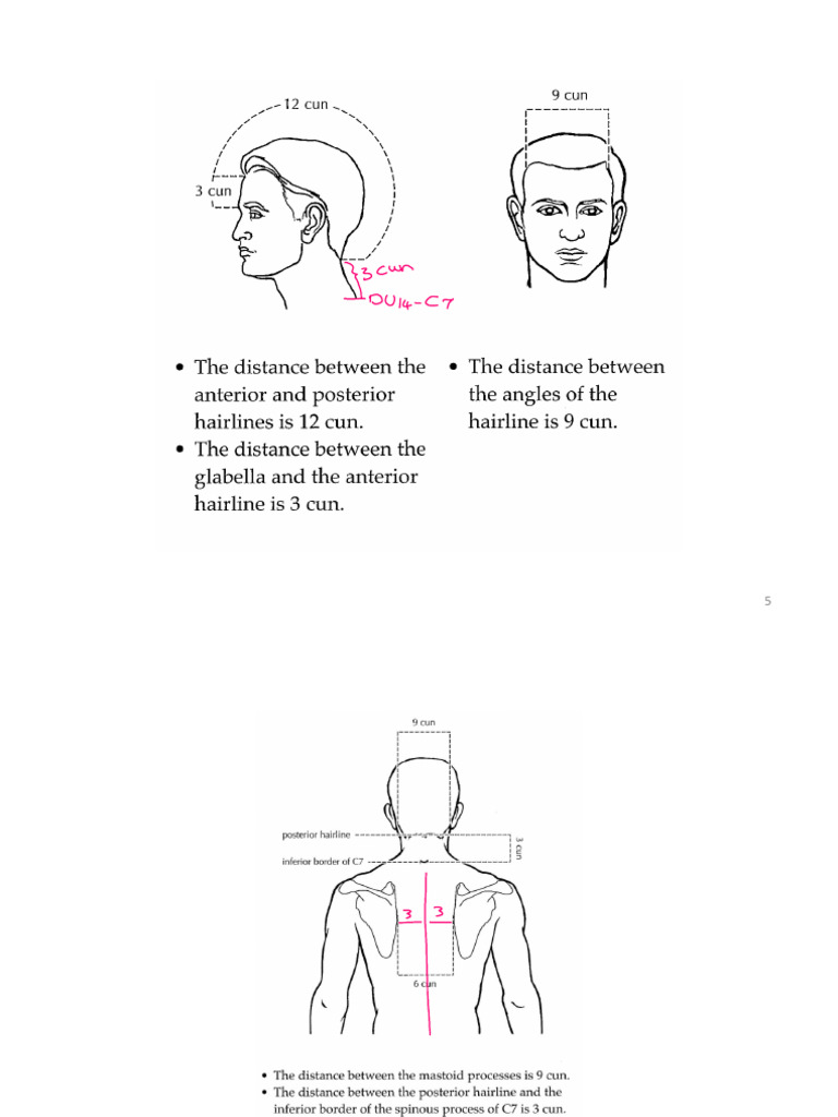 Point Location and Needling | PDF