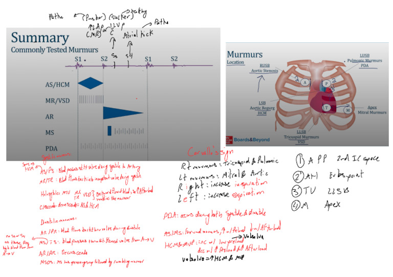 Murmurs | PDF
