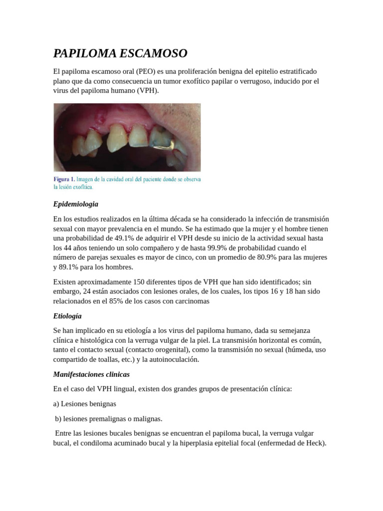 Papiloma Escamoso Oral: Causas y Síntomas | PDF | Especialidades ...