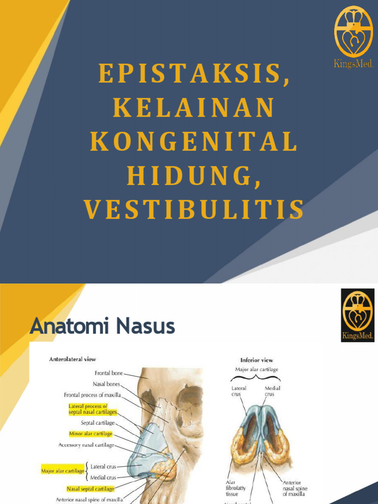 Epistaksis, Kelainan Kongenital Hidung, Vestibulitis | PDF
