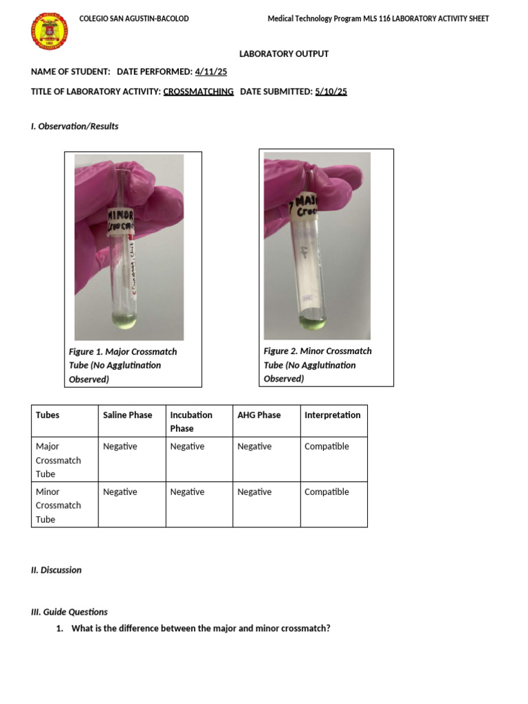 Act. 10 Crossmatching | PDF