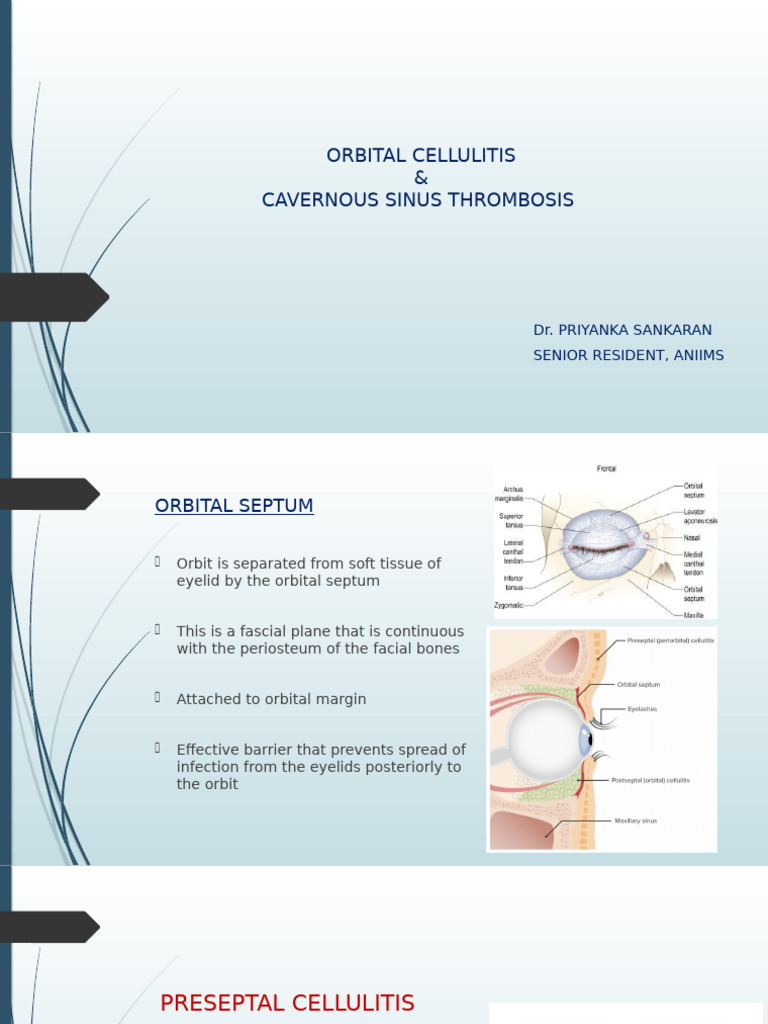 ORBITAL CELLULITIS, Detail Presentation For MBBS | PDF | Vein ...