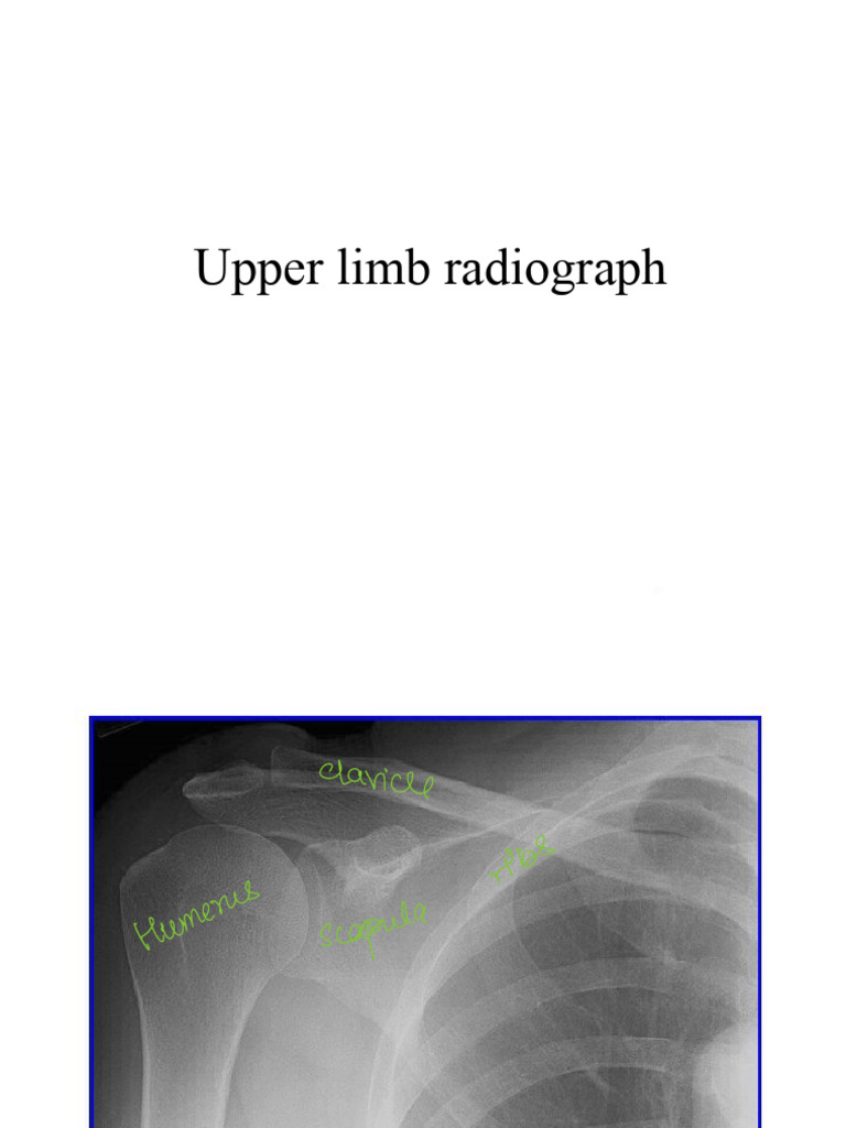 Upper Limb Radiograph | PDF | Heart | Elbow