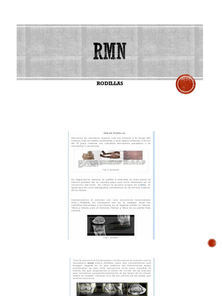 Rmn Rodillas | PDF