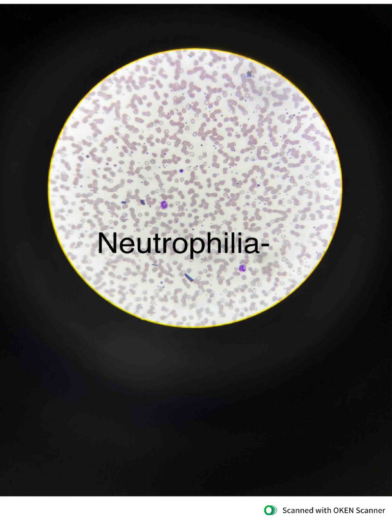 Peripheral Smear | PDF