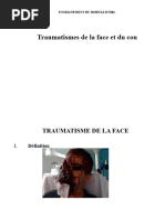 Fracture du rocher : enjeux cliniques | PDF | vertige | Traumatisme crânien