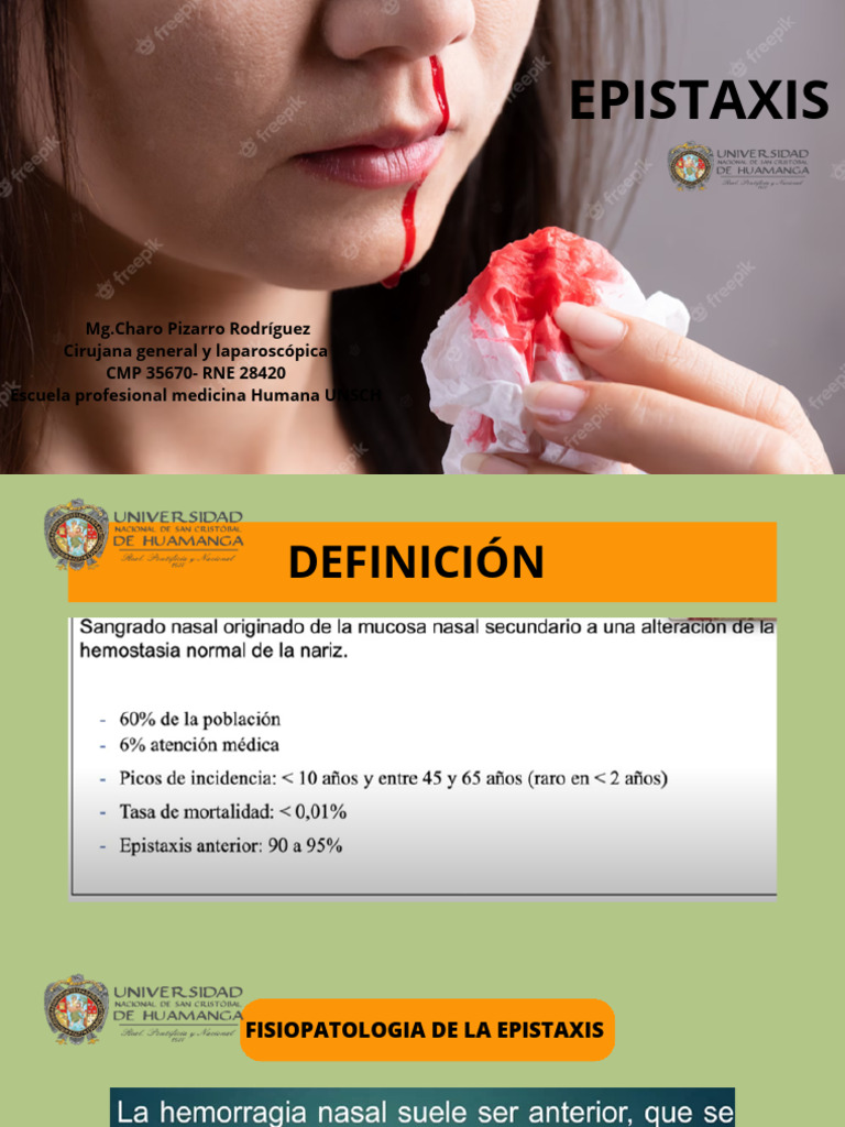 Guía Completa sobre Epistaxis y Tratamiento | PDF