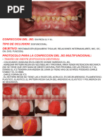 Confección del Jig de Lucia en Odontología | PDF | Ramas de Odontología