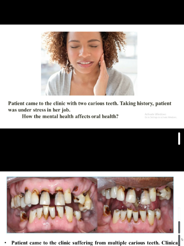 Clinical Patho Caries | PDF