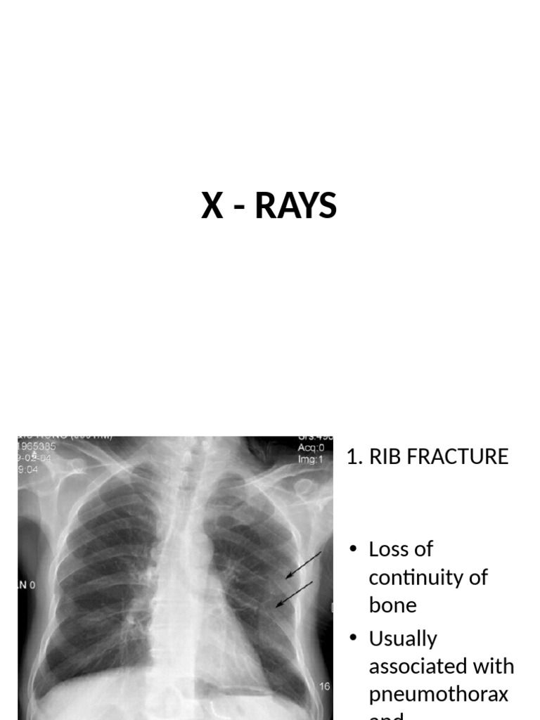 X Rays Pdf