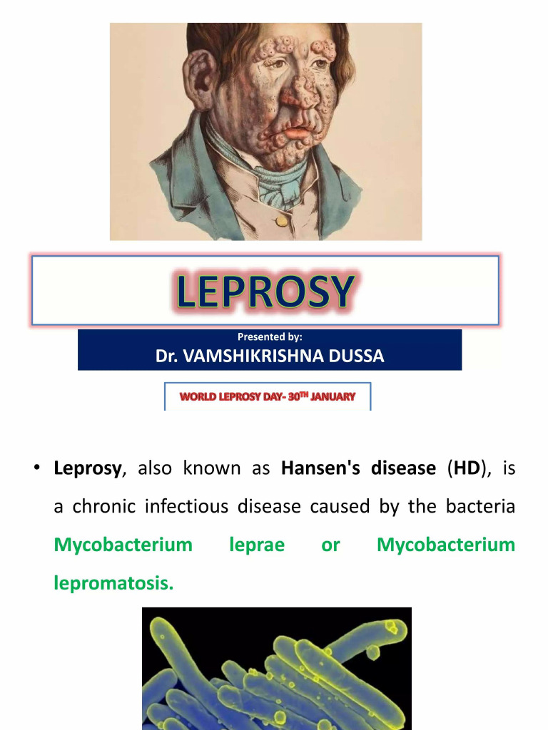 Leprosy | PDF