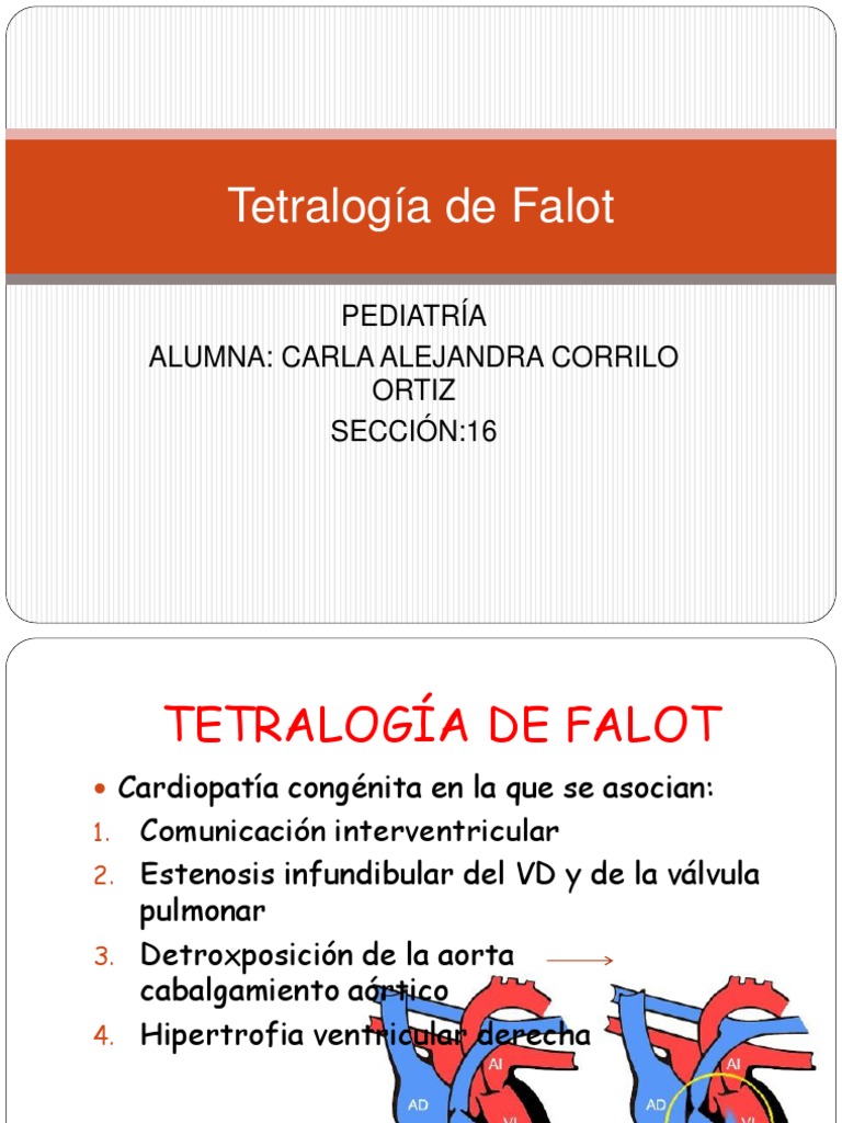 Tetralogía de Falot | PDF | Defecto cardiaco congenito | Especialidades ...