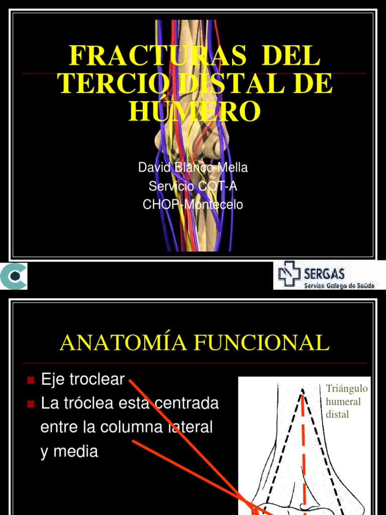 Fx Humero Distal | Codo | Lesión